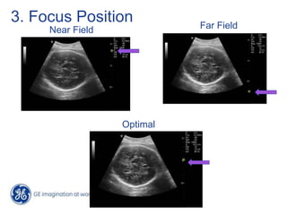 Ultrasound Basic Knobology & Controls | PPTX