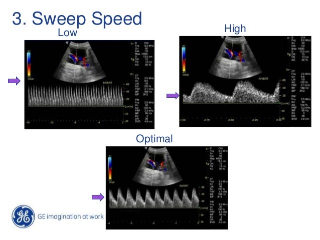 Ultrasound Basic Knobology & Controls