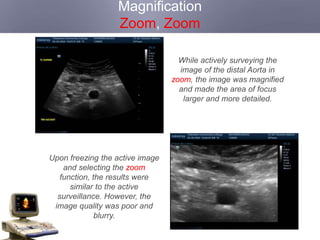 Knobolgy Project for Ultrasound diagnostic imaging | PPTX