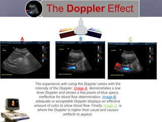 Knobolgy Project for Ultrasound diagnostic imaging | PPTX