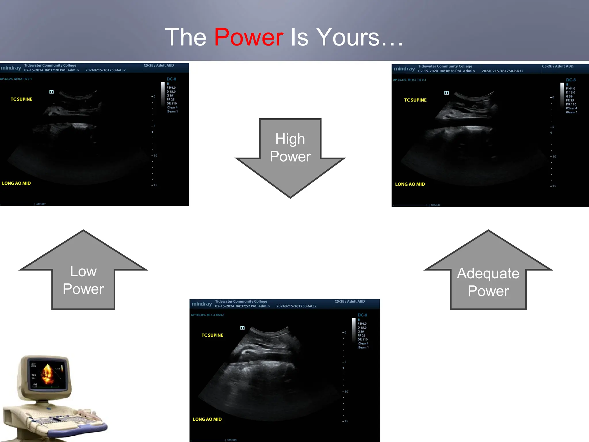 Knobolgy Project for Ultrasound and imaging | PDF