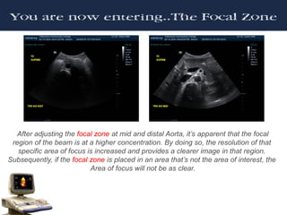 Knobolgy Project for Ultrasound and imaging | PDF