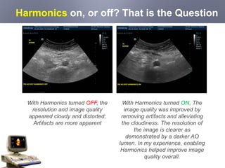 Knobolgy Project for Ultrasound and imaging | PDF