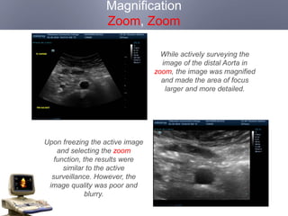 Knobolgy Project for Ultrasound and imaging | PDF