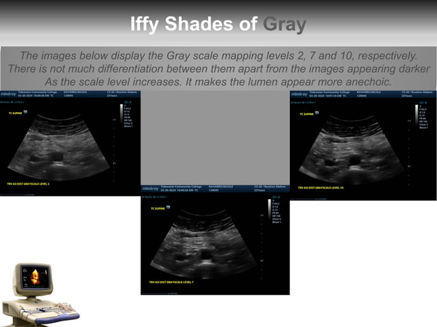 Knobolgy Project for Ultrasound and imaging | PDF