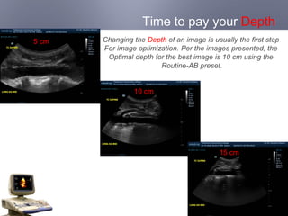 Knobolgy Project for Ultrasound and imaging | PDF