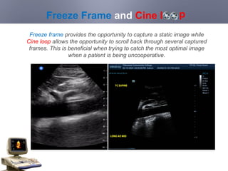Knobolgy Project for Ultrasound and imaging | PDF