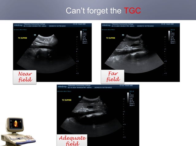 Knobolgy Project for Ultrasound and imaging | PDF