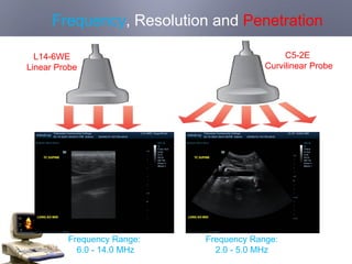 Knobolgy Project for Ultrasound and imaging | PDF