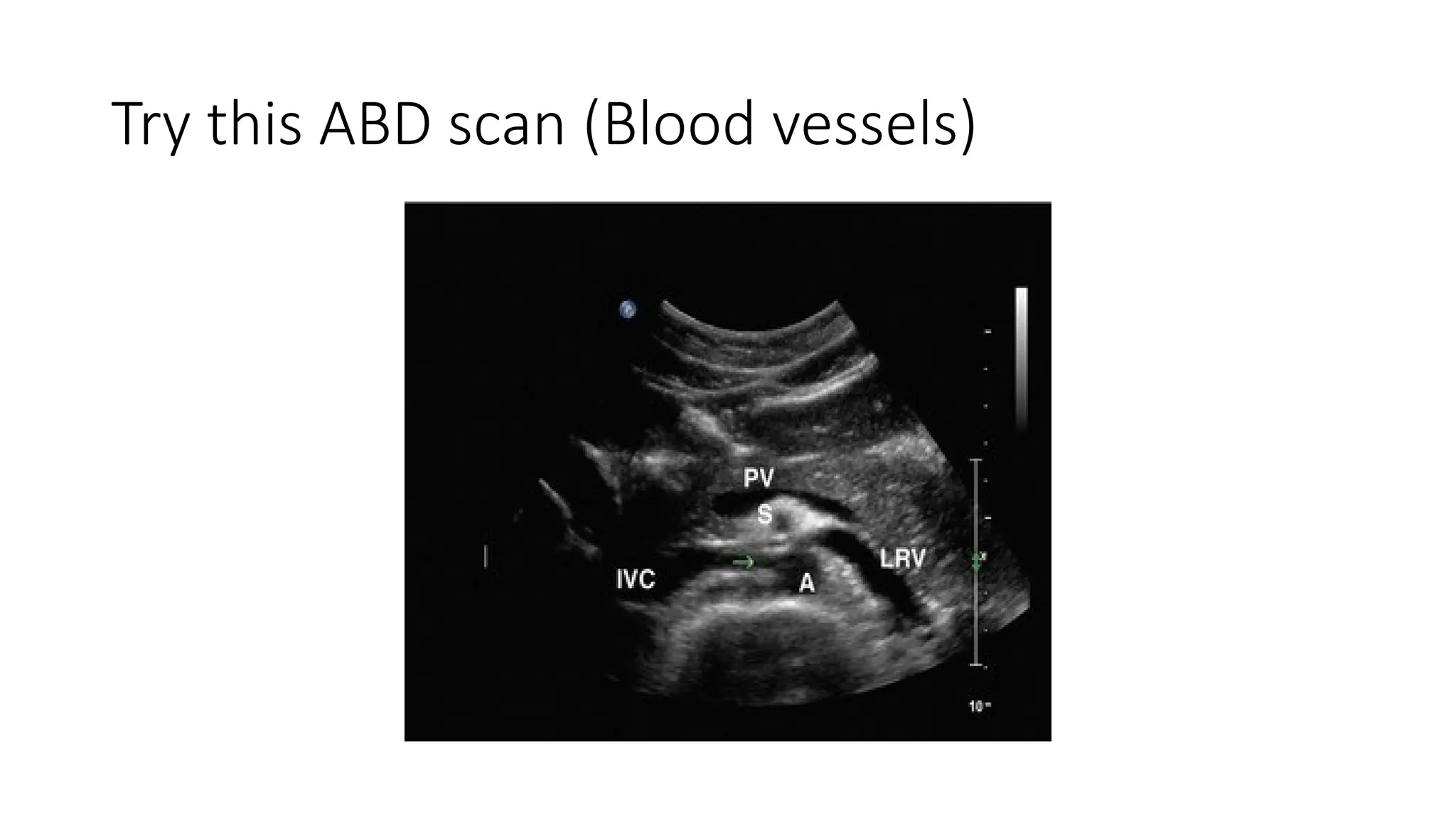 KNOBOLOGY SUMMARY IN ULTRASONOGRAPHY.pptx