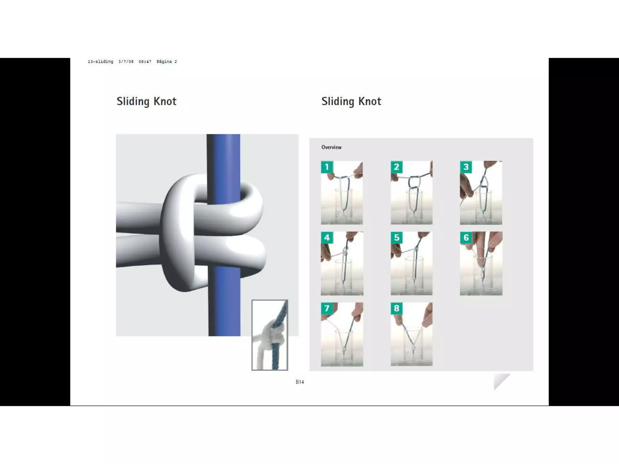 Knotting & anastomosis | PPTX | First Aid | Injuries
