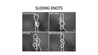 Knotting Techniques.pptx | Surgery | Medical Health