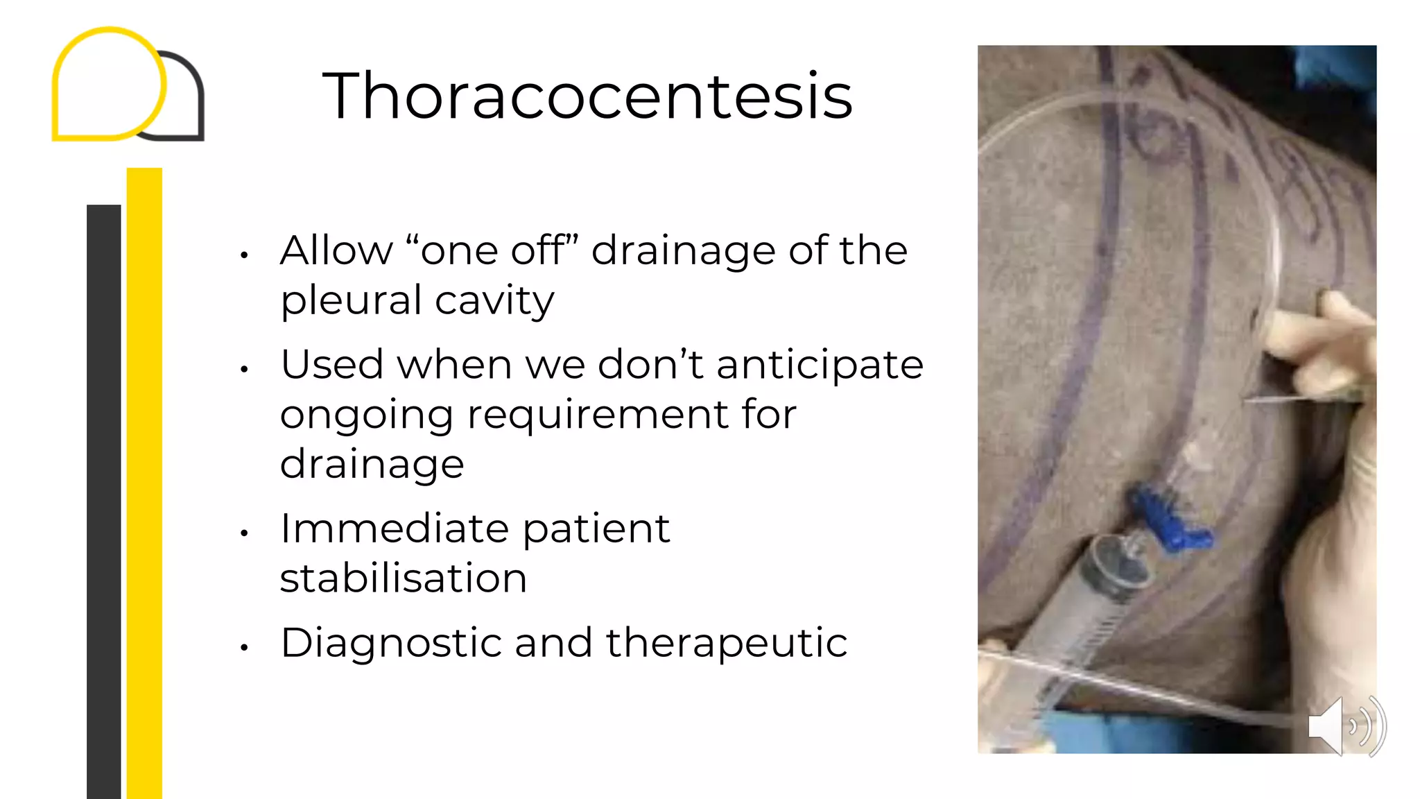 Know how to thoracocentesis and thoracostomy tubes | PPTX