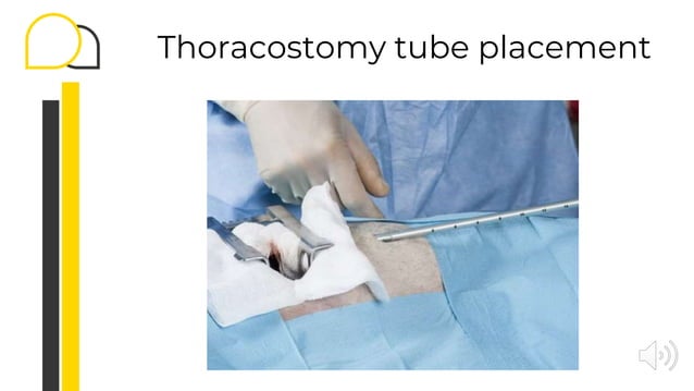 Know how to thoracocentesis and thoracostomy tubes | PPTX