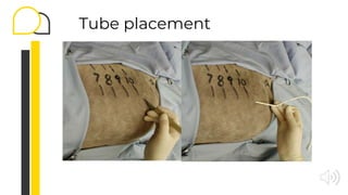 Know how to thoracocentesis and thoracostomy tubes | PPTX