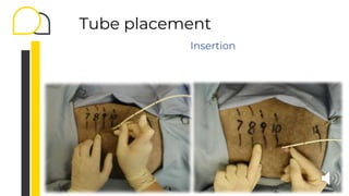 Know how to thoracocentesis and thoracostomy tubes | PPTX
