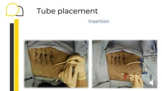 Know how to thoracocentesis and thoracostomy tubes | PPTX