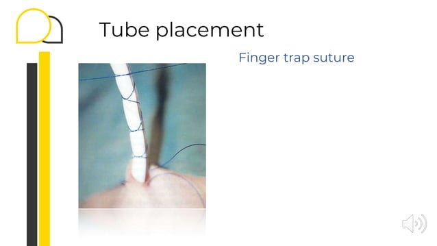 Know how to thoracocentesis and thoracostomy tubes | PPTX
