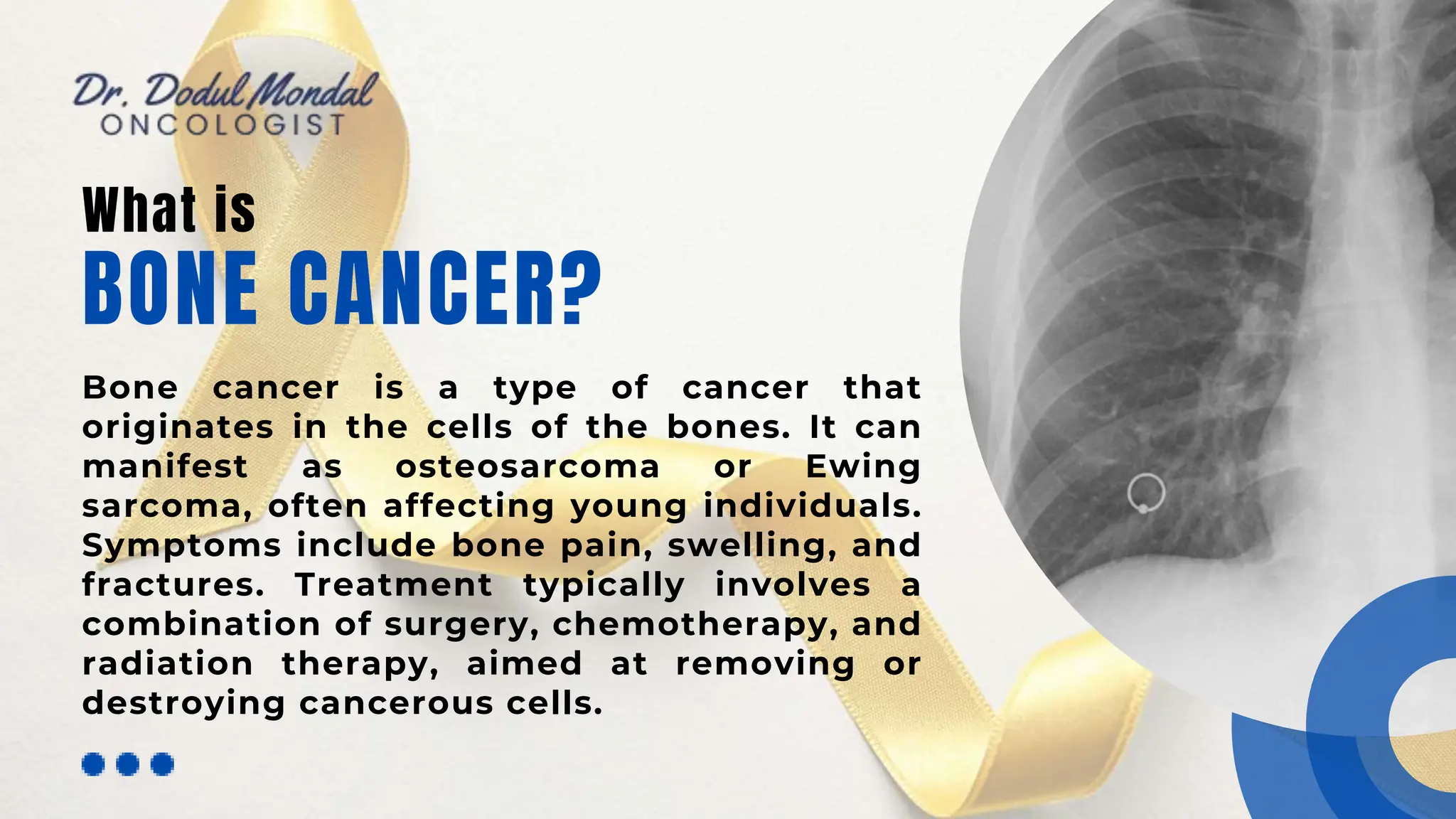 Know about Bone Cancer Sign and Treatment Dr. Dodul Mondal.pptx