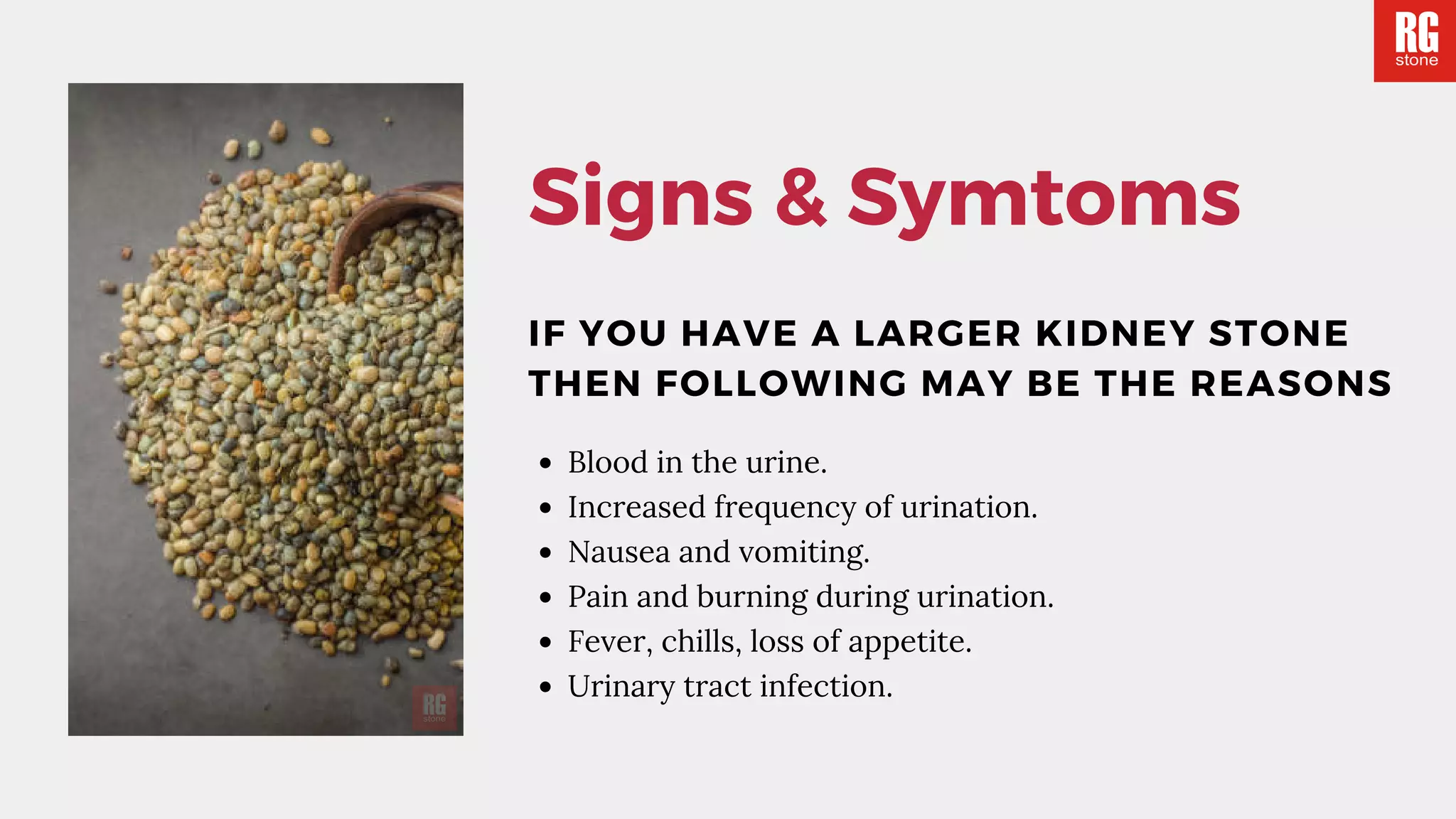 All You Need to Know About kidney Stone - by RG Stone Hospital | PDF