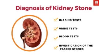 All You Need to Know About kidney Stone - by RG Stone Hospital | PDF