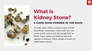 All You Need to Know About kidney Stone - by RG Stone Hospital | PDF