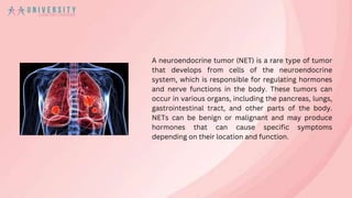 Know About Neuroendocrine Tumor - University Cancer Centers | PPT