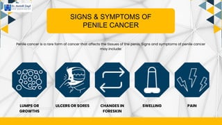 know about penile cancer: Diagnosis, Symptoms | PPTX | Sexual ...