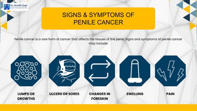 know about penile cancer: Diagnosis, Symptoms | PPTX | Sexual ...