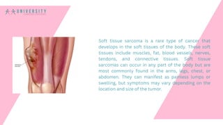Know About Soft Tissue Sarcoma | PPT
