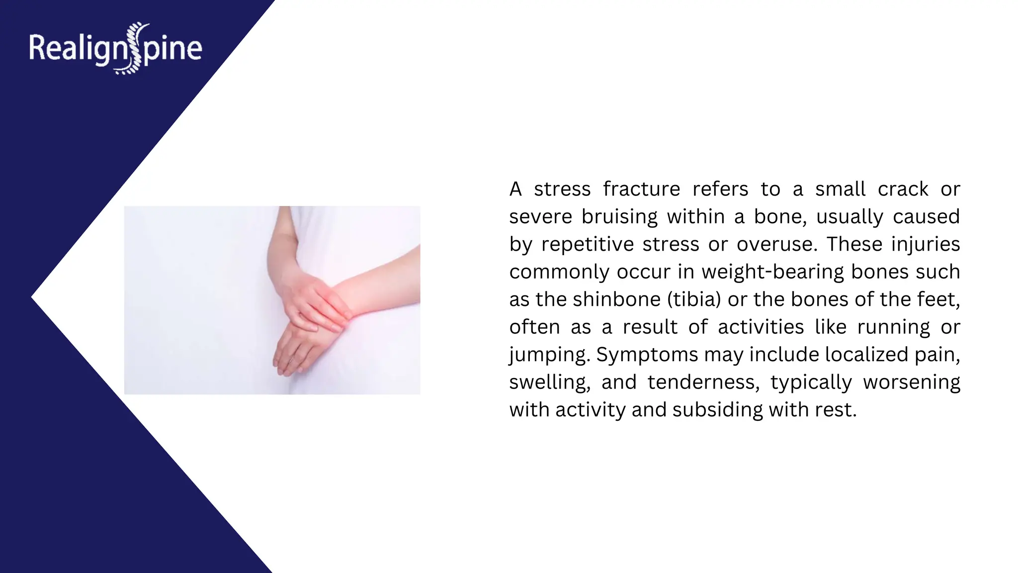Know About Stress Fracture - Realign Spine | PPT