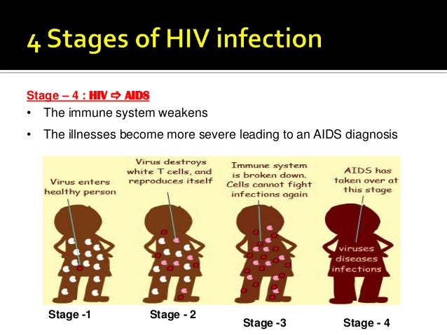 Know aids for no AIDS