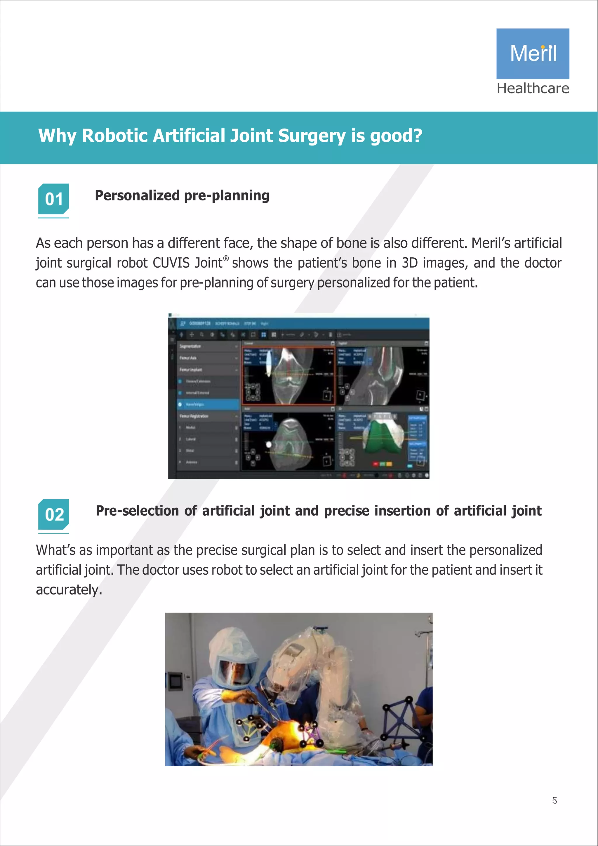 Know all about Latest CUVIS JOINT Robotic System Online at Meril Life | PDF