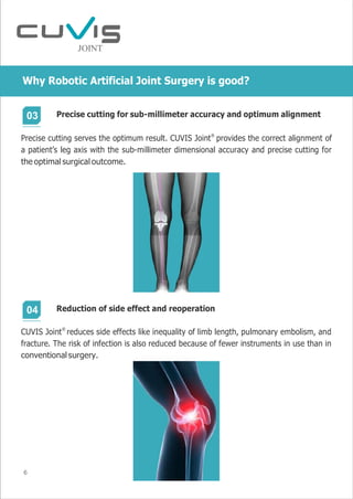 Know all about Latest CUVIS JOINT Robotic System Online at Meril Life | PDF