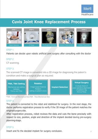 Know all about Latest CUVIS JOINT Robotic System Online at Meril Life | PDF