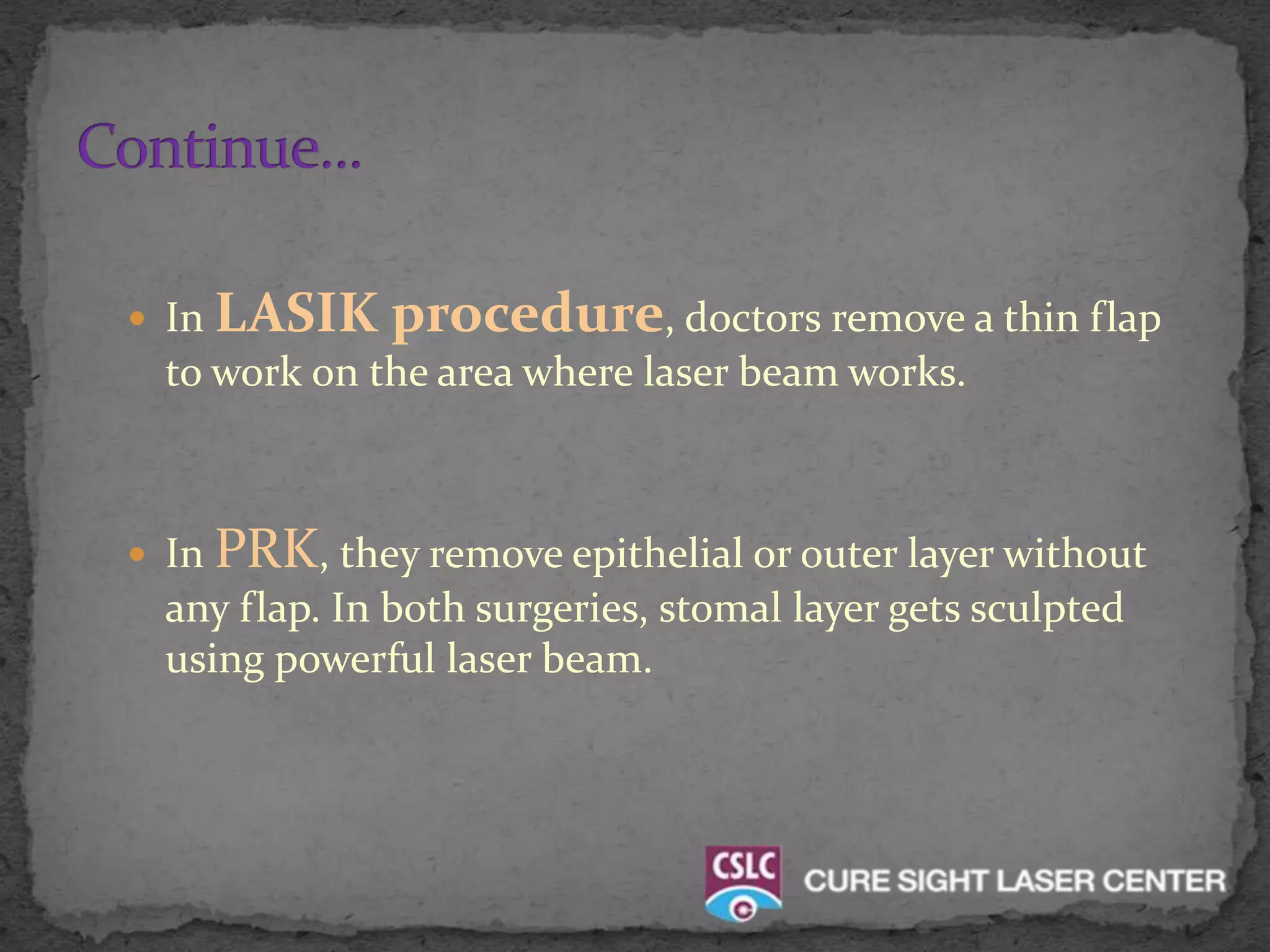 Know everything about prk method eye surgery | PPTX