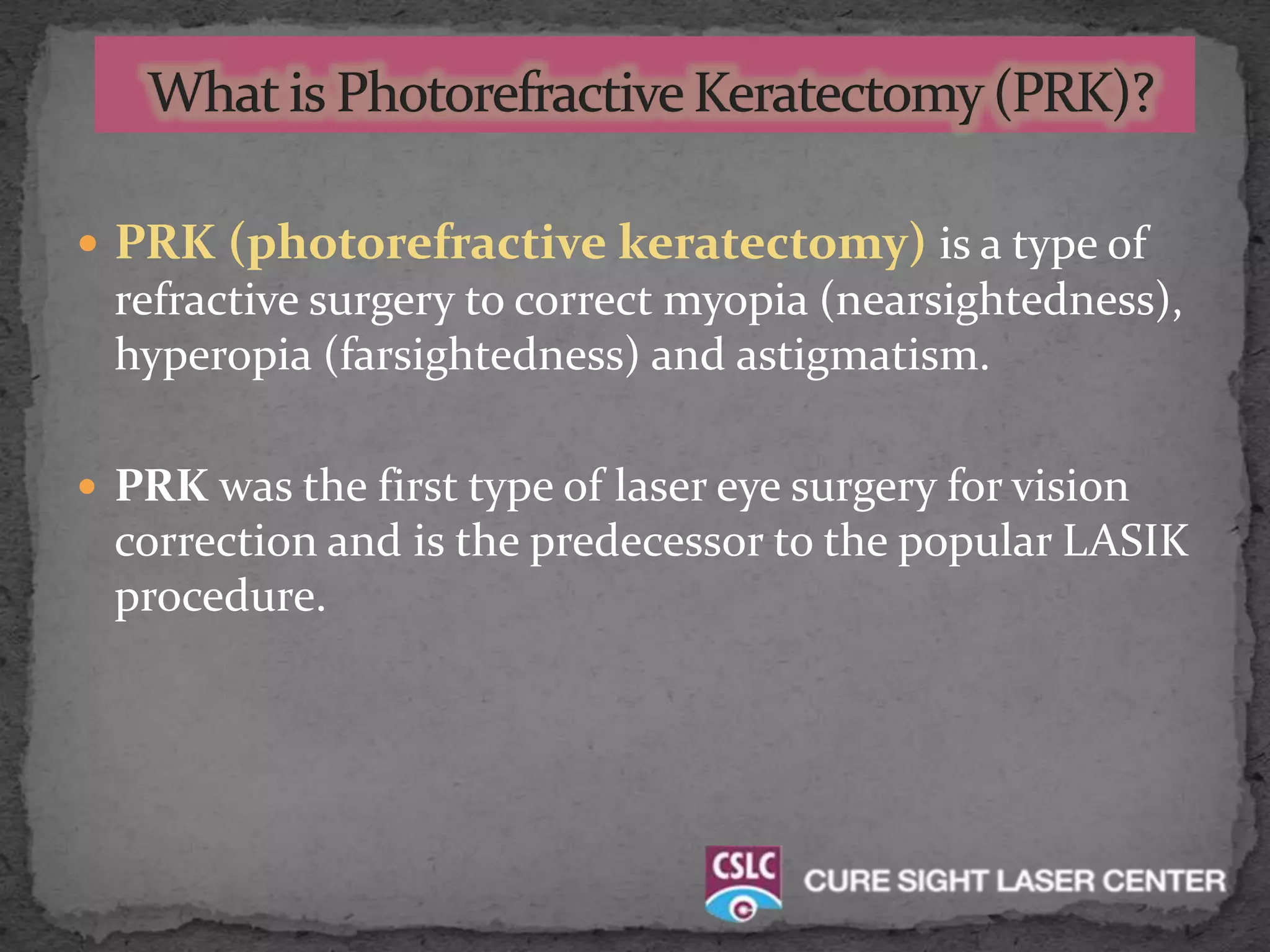 Know everything about prk method eye surgery | PPTX