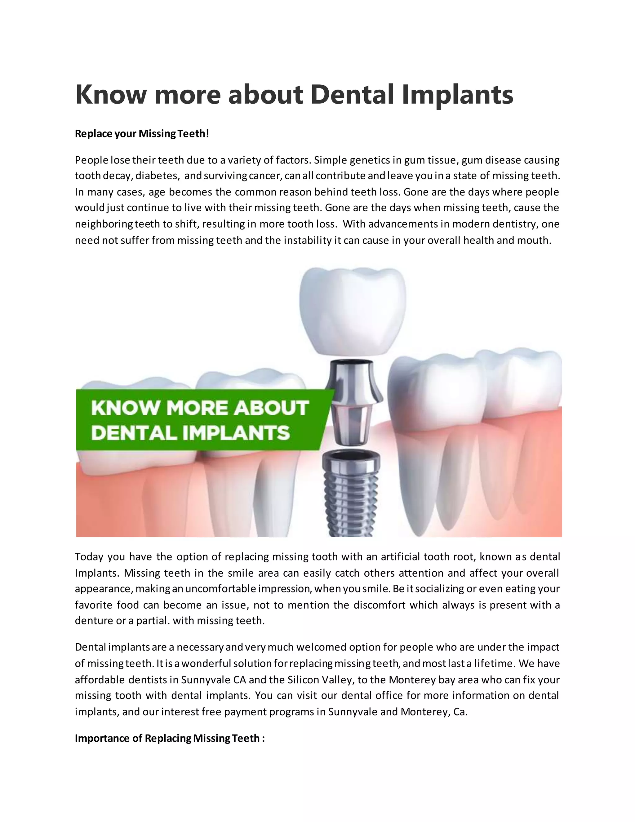 Know more about dental implants | PDF