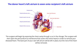 Know More About Heart Transplantation | PPTX