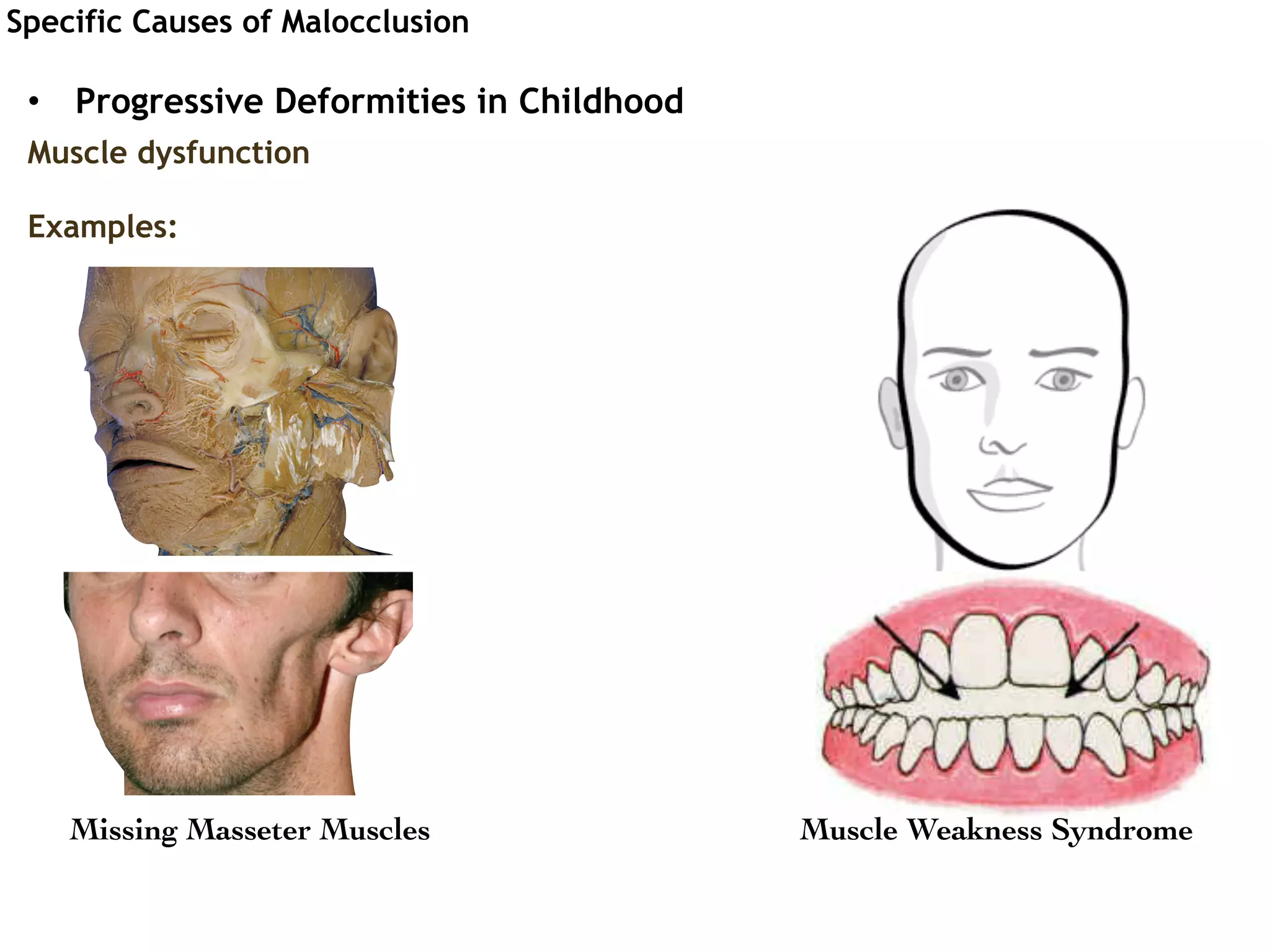Known causes of Malocclusion | PDF