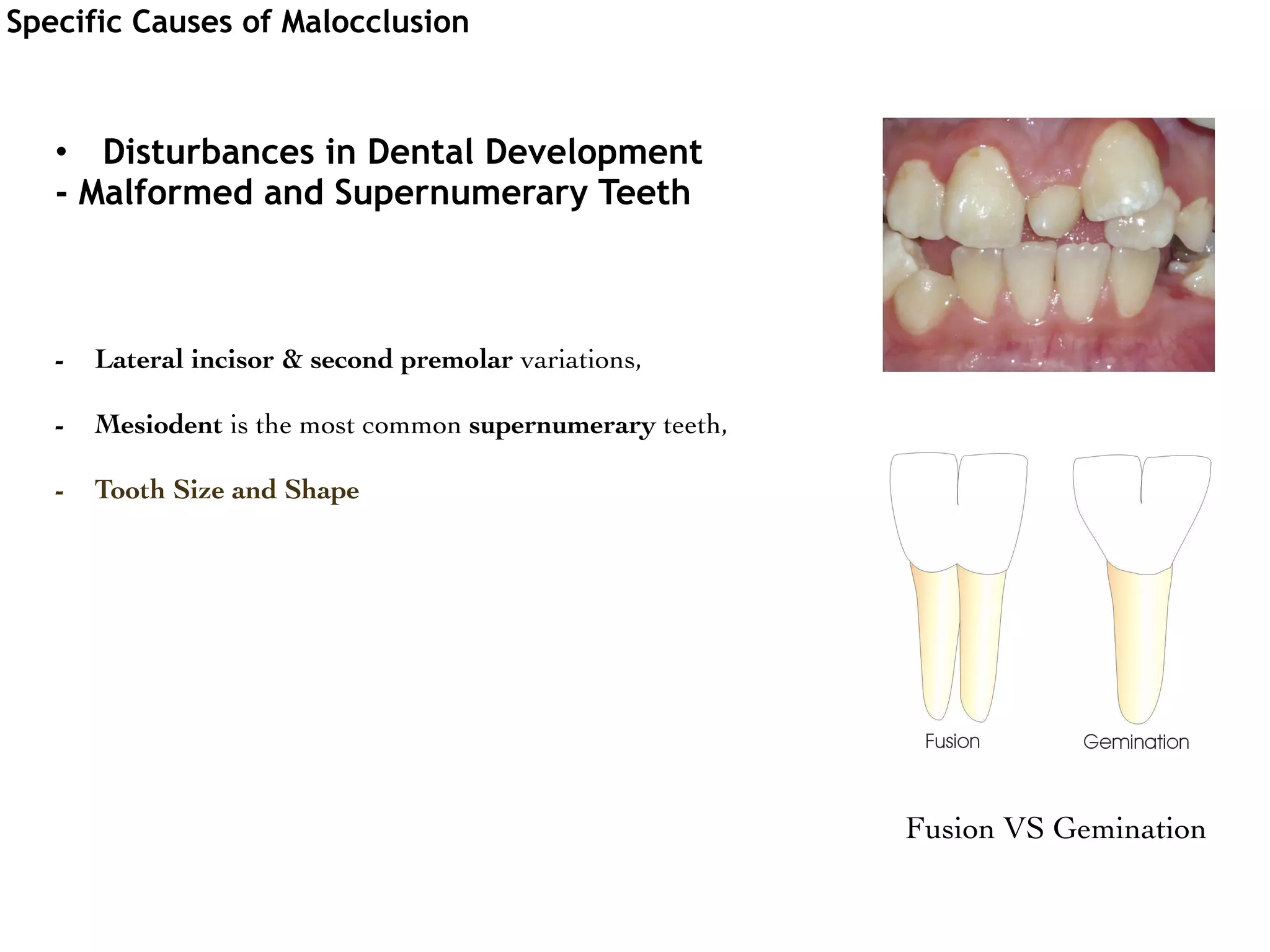 Known causes of Malocclusion | PDF
