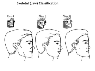 Known causes of Malocclusion | PDF
