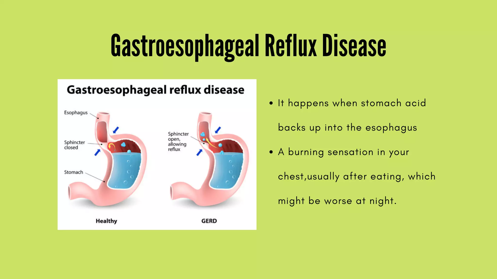 Know The Most Common Gastrointestinal Diseases | PDF | Digestive ...