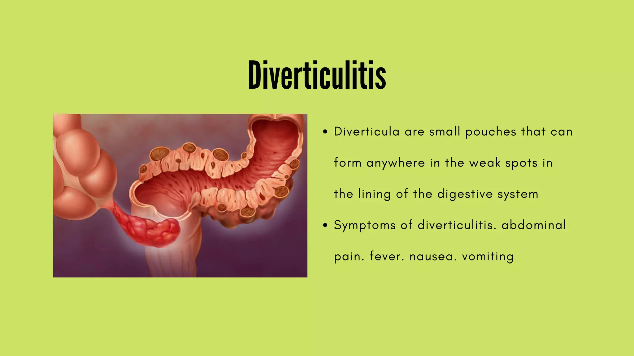 Know The Most Common Gastrointestinal Diseases | PDF | Digestive ...