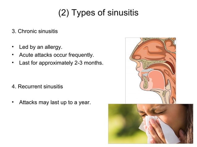 Know More Your Sinusitis, Its Types and Treatment! | PPT | Ear, Nose ...
