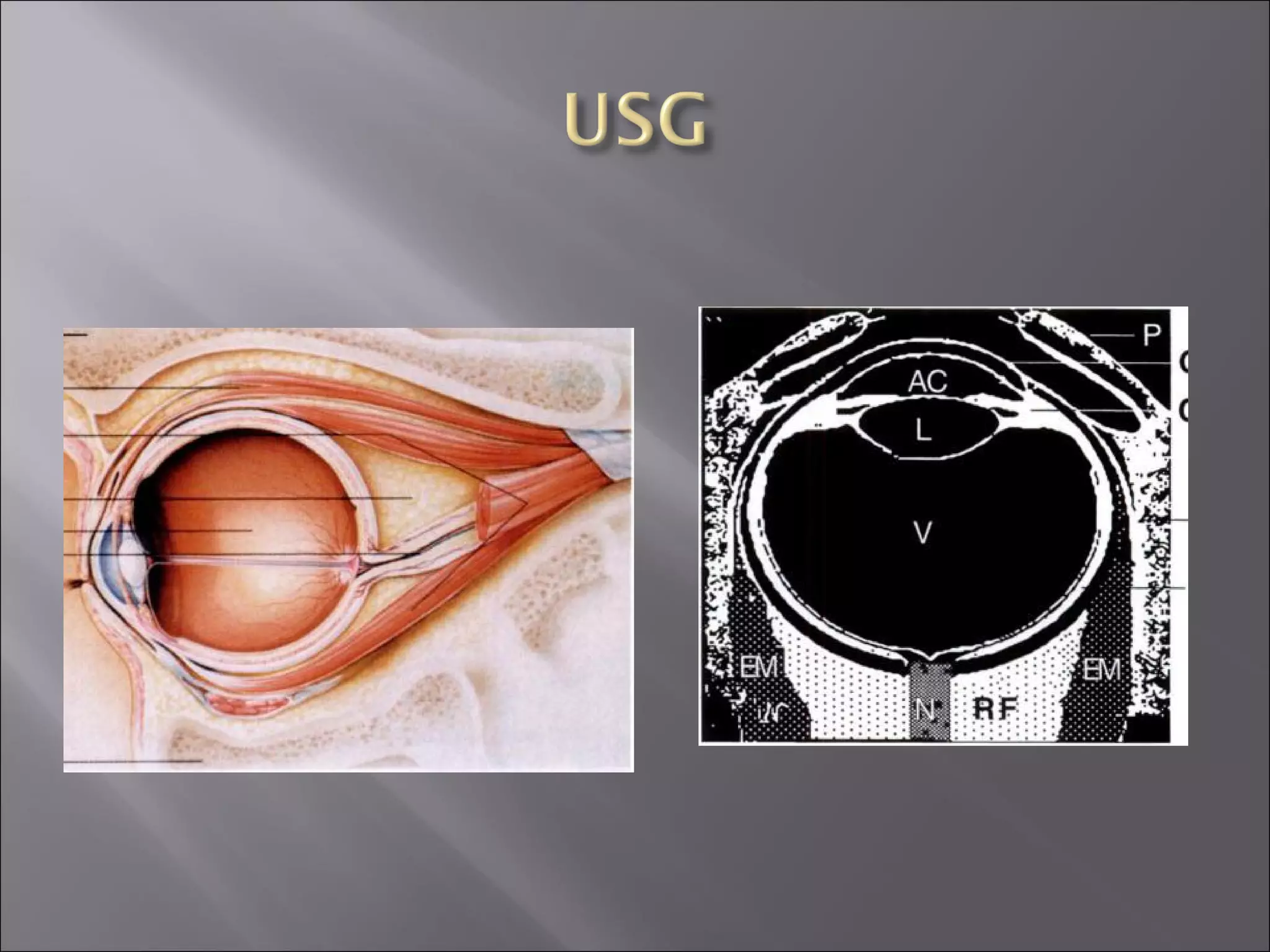 Ocular Imaging --Know yr eyes | PPT
