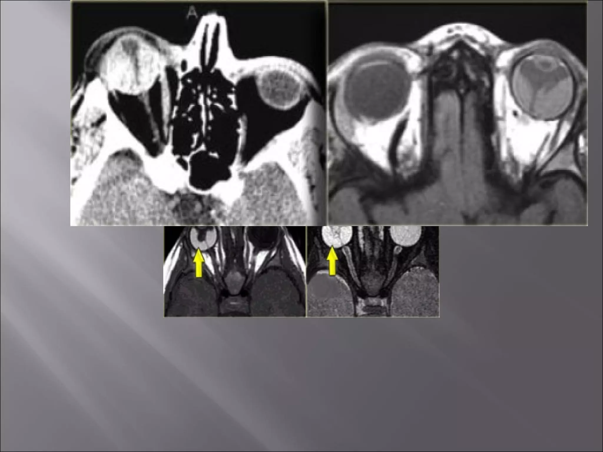 Ocular Imaging --Know yr eyes | PPT
