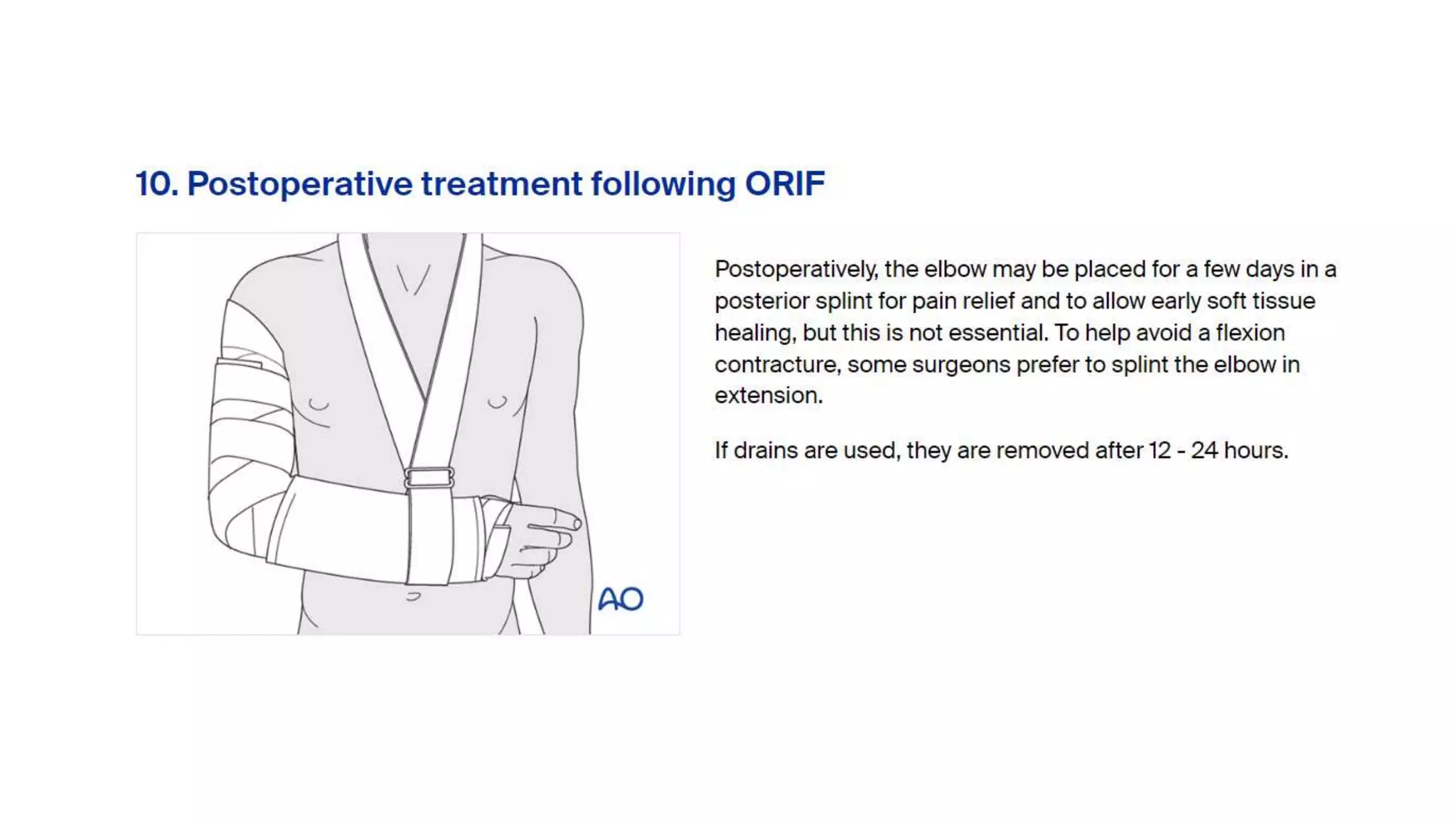 Kocher Approach for Radial Head Fracture.pptx