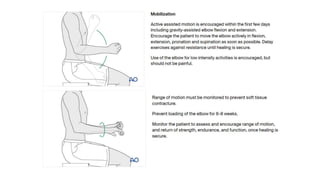 Kocher Approach for Radial Head Fracture.pptx