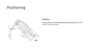 Kocher Approach for Radial Head Fracture.pptx